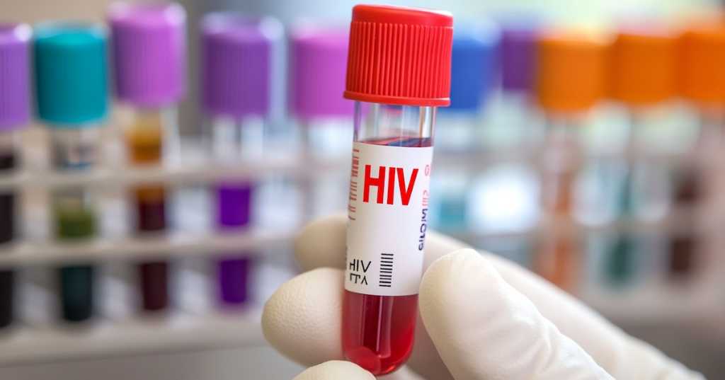 Indetectable=intransmisible: de qué se trata este concepto que cambió ...